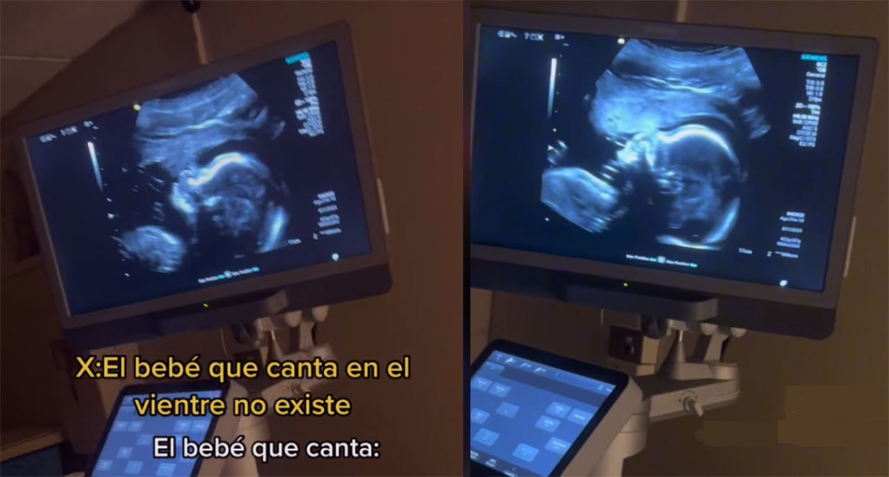 Bebé canta en el vientre de su madre durante ecografía